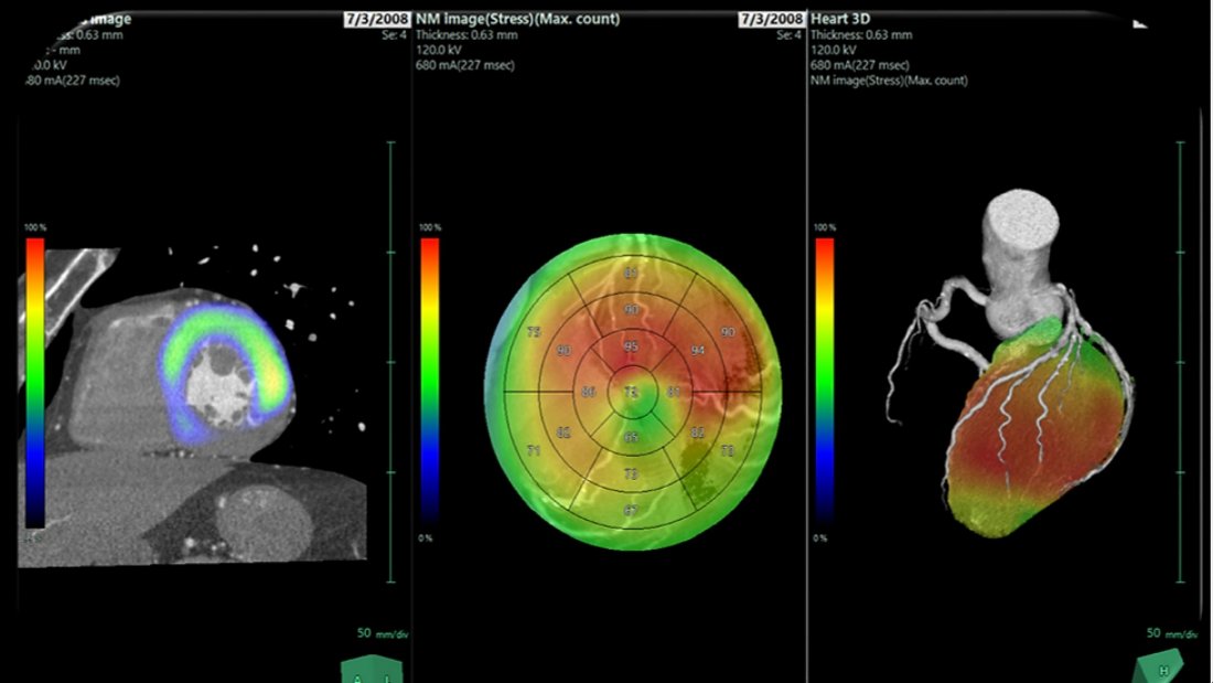 Dubai Cardiac CT Level 1/2 Course Tickets | Fujifilm Technology Center ...